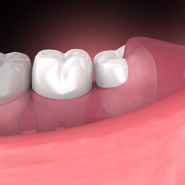 Capital Oral & Facial Surgery - Raleigh NC Oral Surgeons