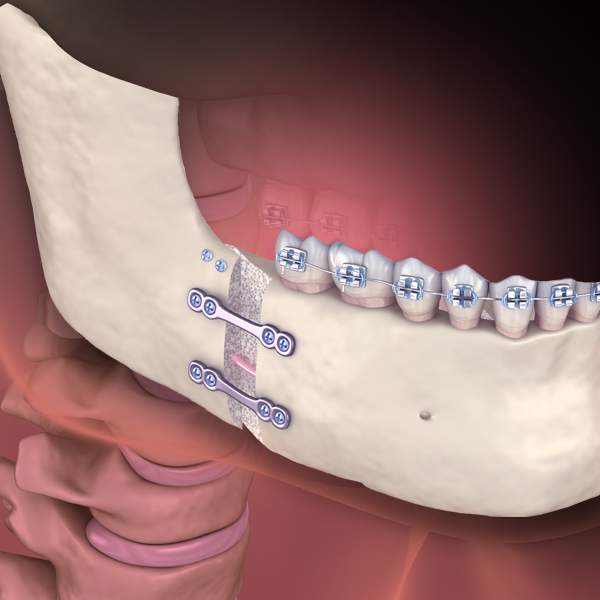 Oral and Maxillofacial Surgery Riverside CA | Oral Surgeon Riverside